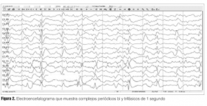 ELECTROENCEFALOGRAMA - ELECTROENCEFALOGRAFIA